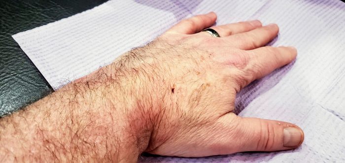 My Attempt to Become a Disney Cyborg — Part I | TouringPlans.com Blog